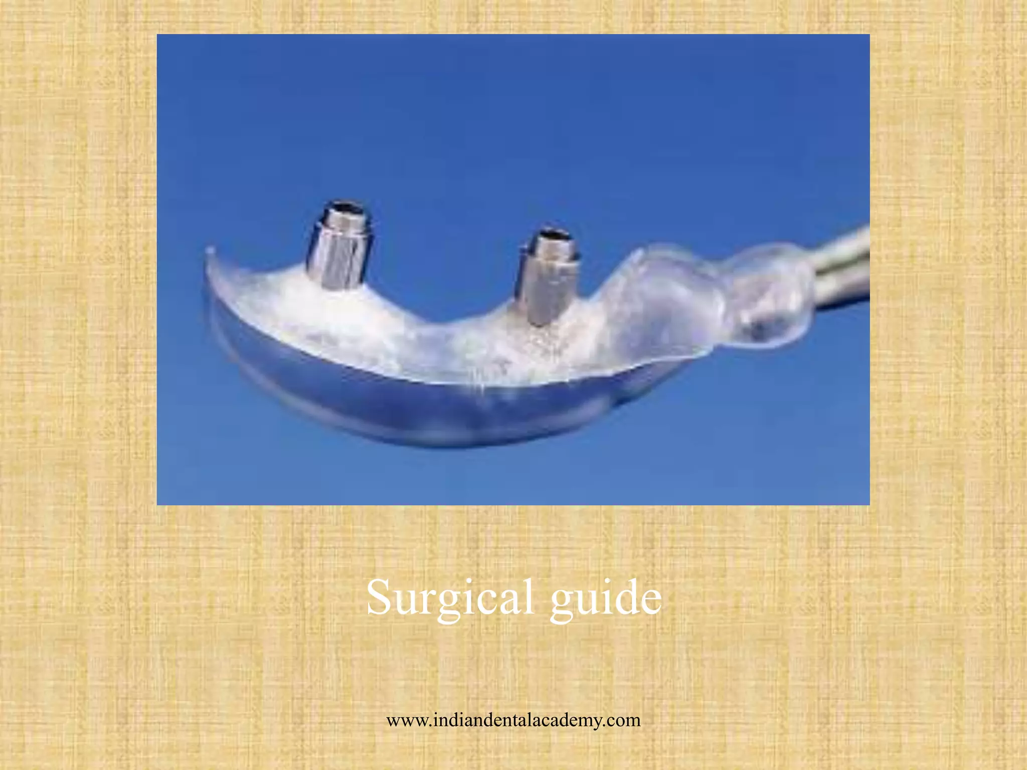 Surgical implant placement guides/ dentistry dental implants | PPT