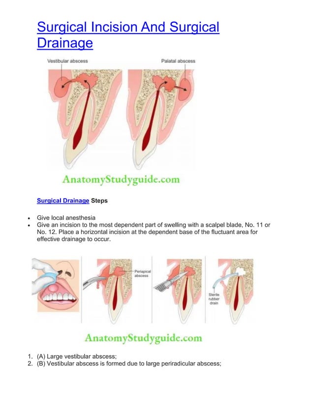 Surgical Incision And Drainage | PDF | Dental Health | Diseases and ...