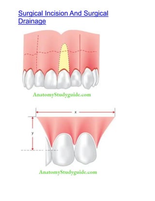 Surgical Incision And Drainage | PDF