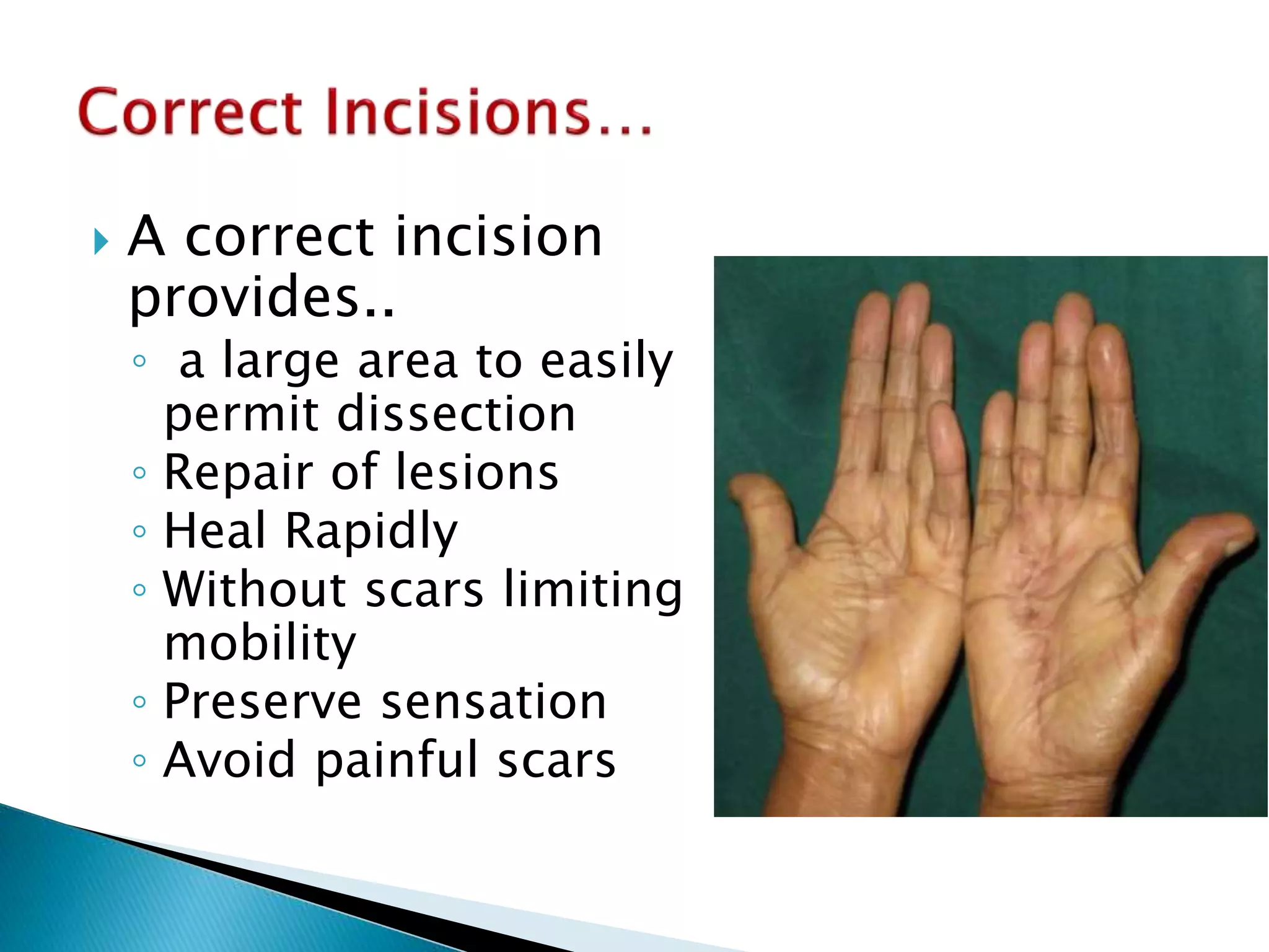 Surgicalincisions 150519180458-lva1-app6892 | PPT