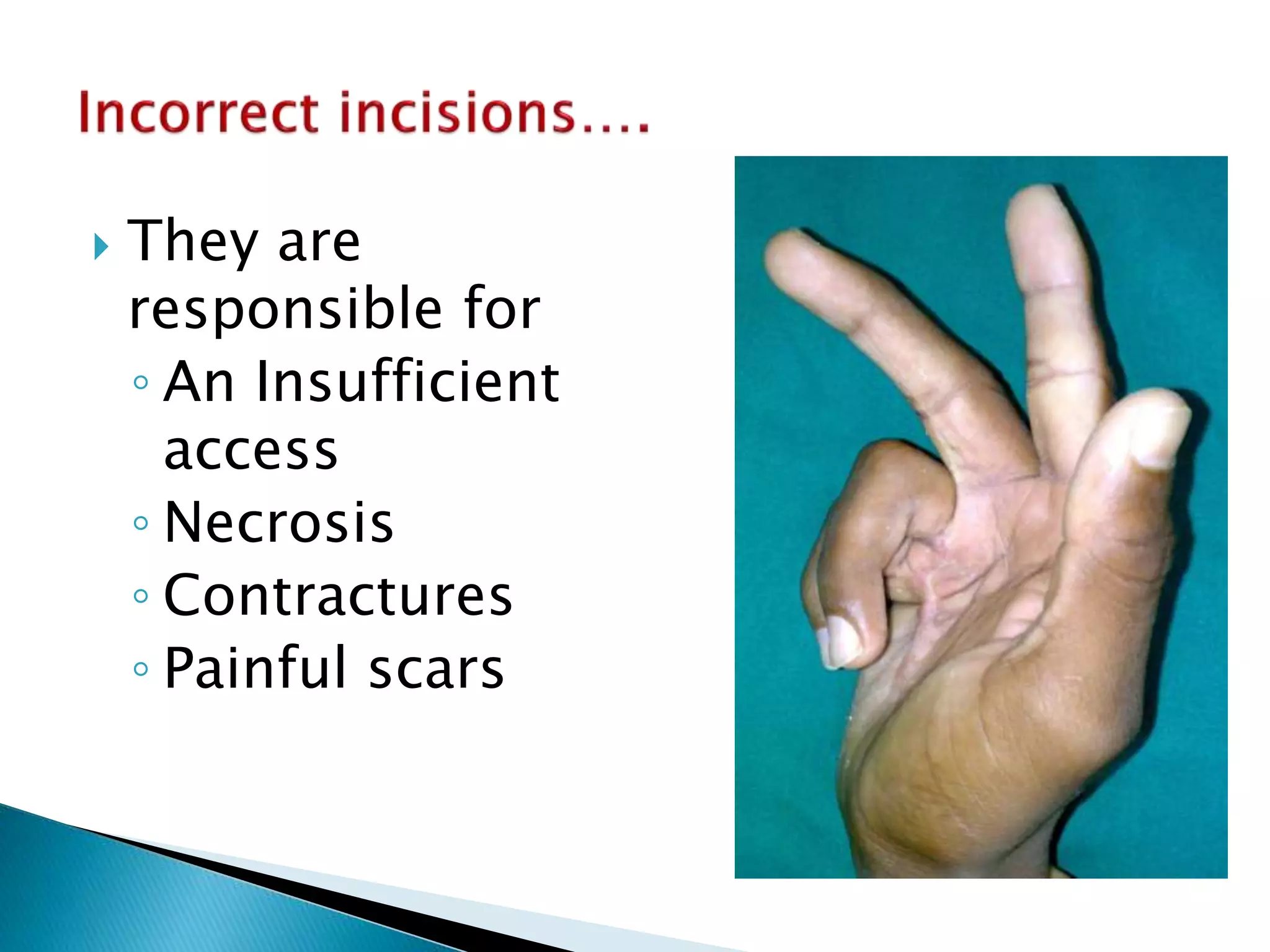 Surgicalincisions 150519180458-lva1-app6892 | PPT