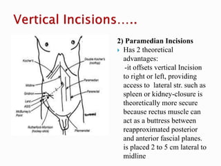 Surgicalincisions 150519180458-lva1-app6892 | PPT
