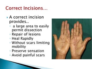 Surgicalincisions 150519180458-lva1-app6892 | PPT