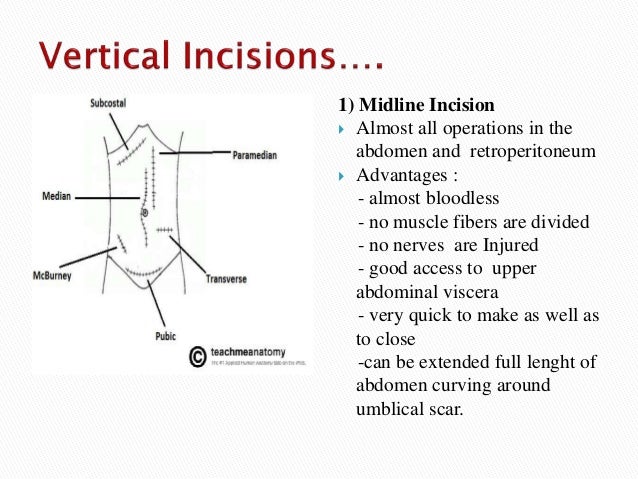 Surgicalincisions 150519180458-lva1-app6892