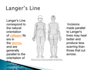 Surgical incisions | PPTX