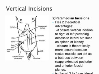 Surgical incisions | PPTX