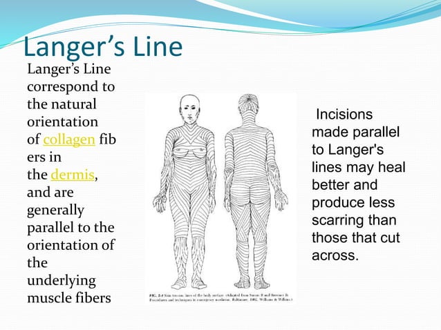 Skin Incisions