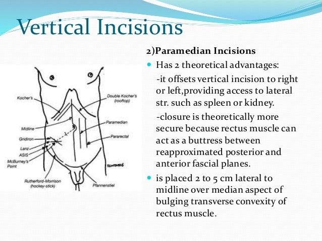 skin incisions