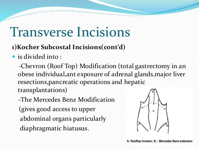 skin incisions