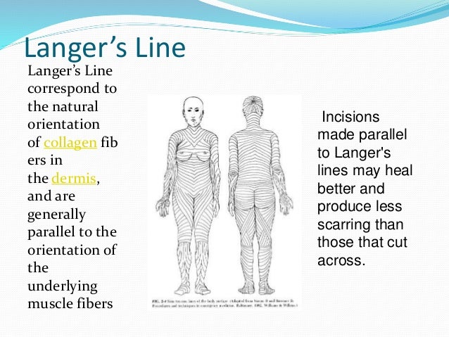 Skin Incisions
