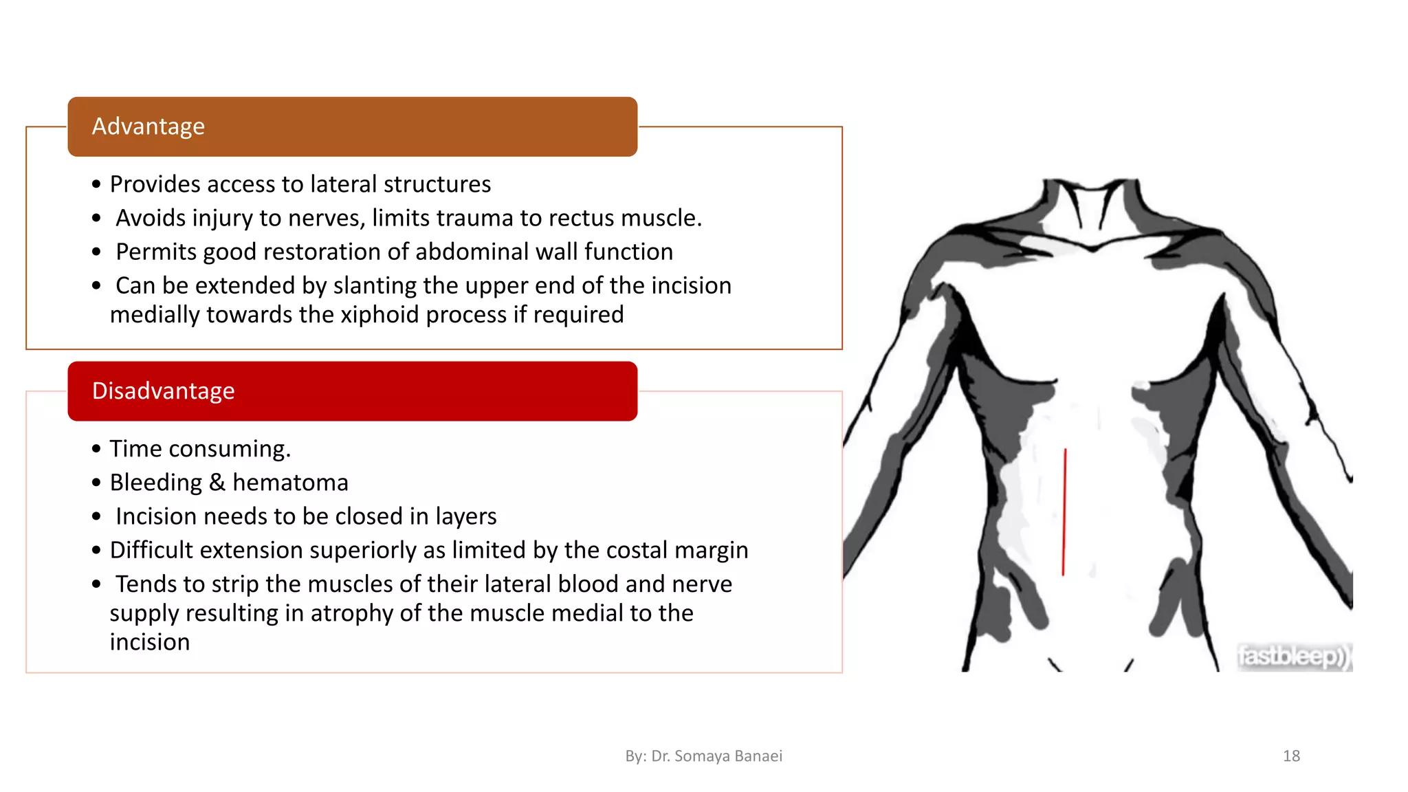 Surgical incisions | PDF