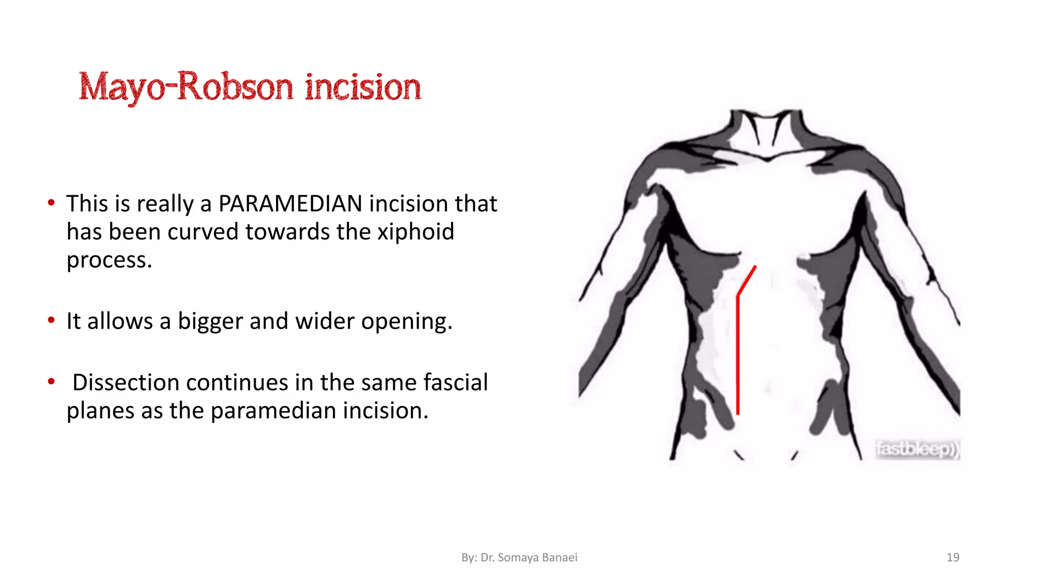 Surgical incisions | PDF