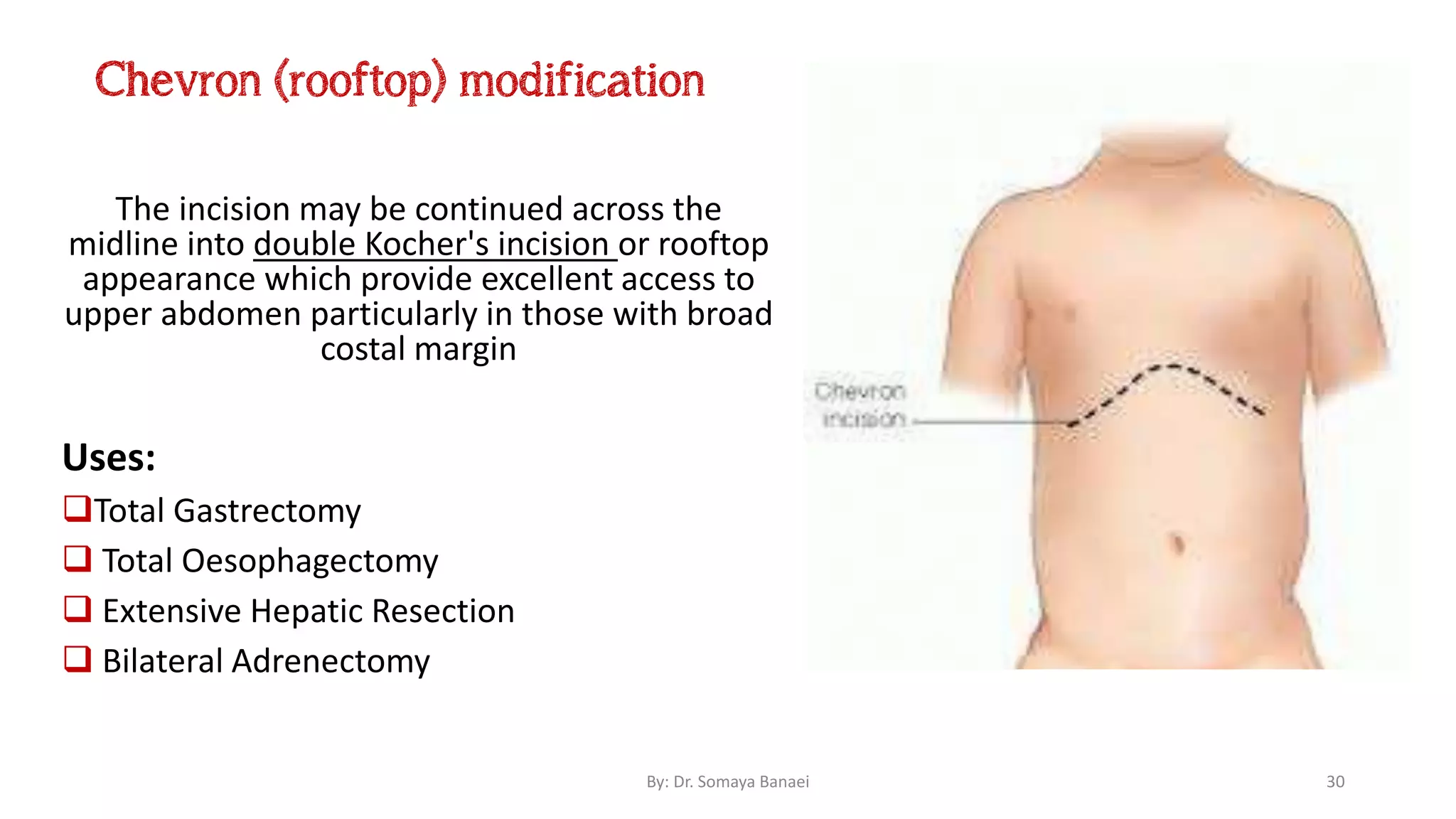 Surgical incisions | PDF