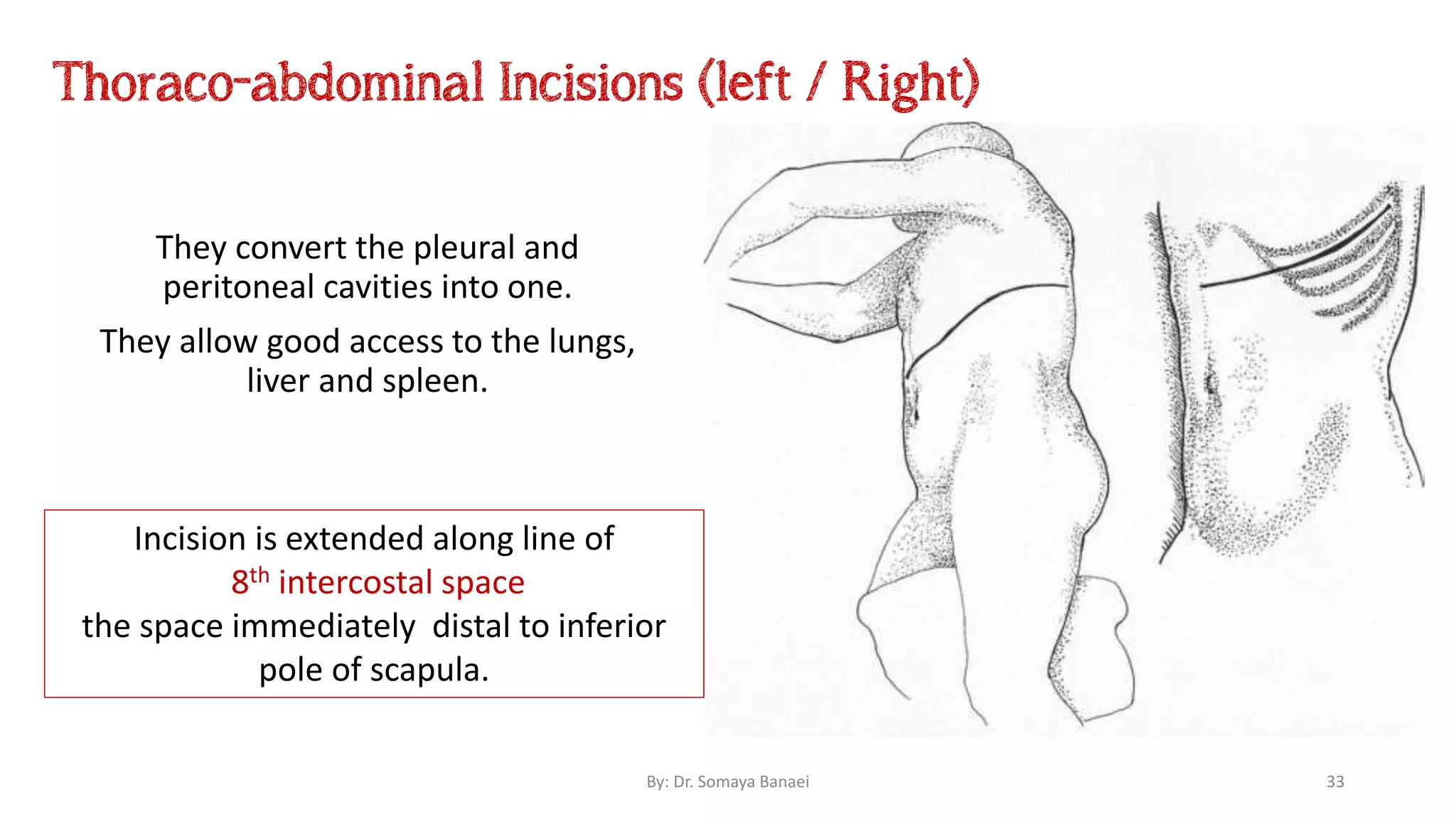 Surgical incisions | PDF