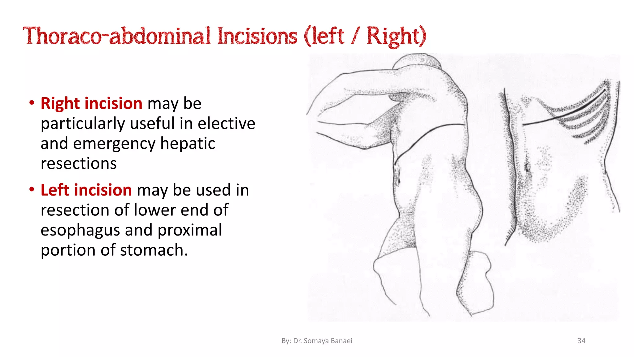 Surgical incisions | PDF