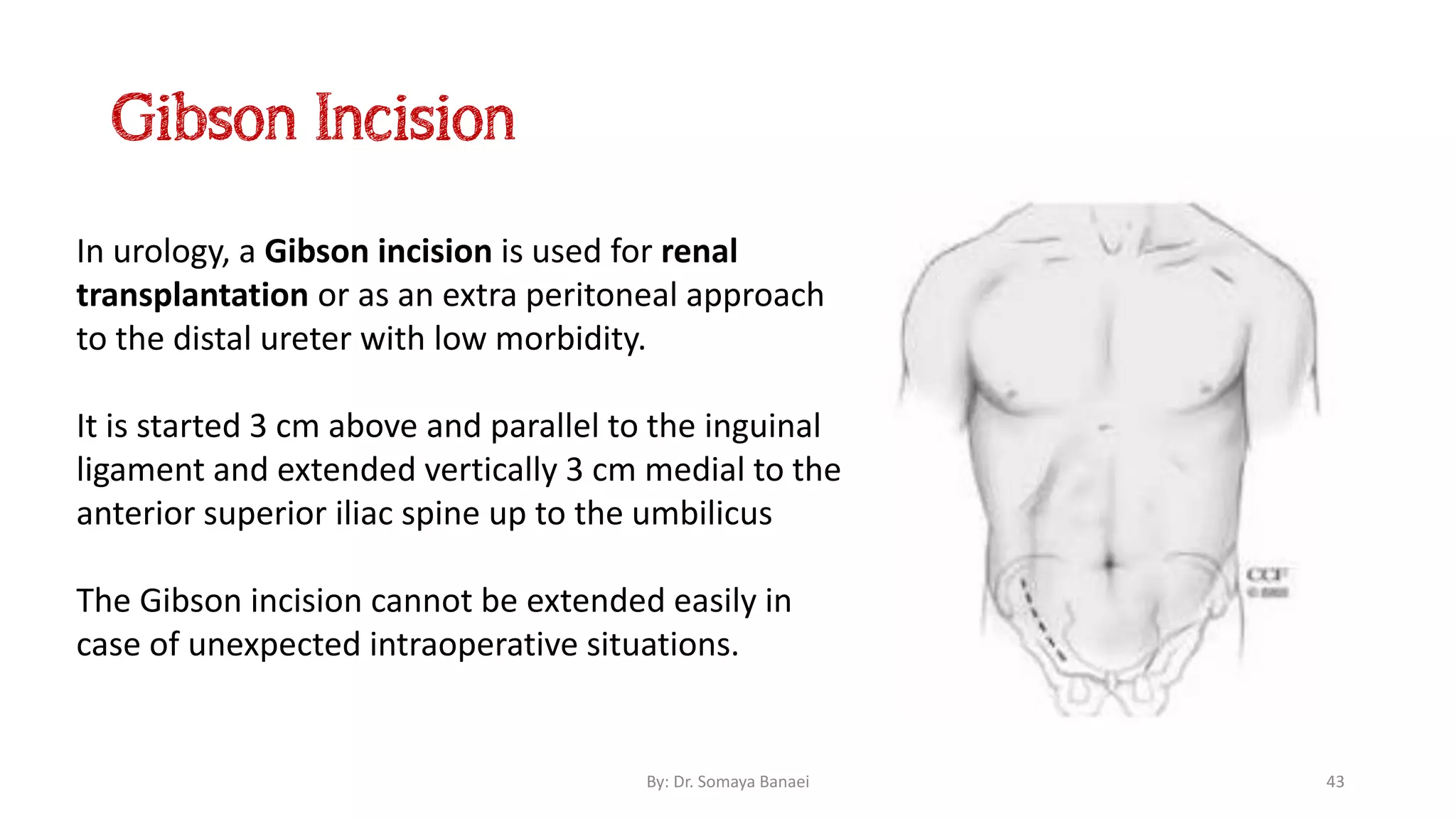 Surgical incisions | PDF