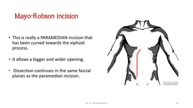 Surgical incisions | PDF