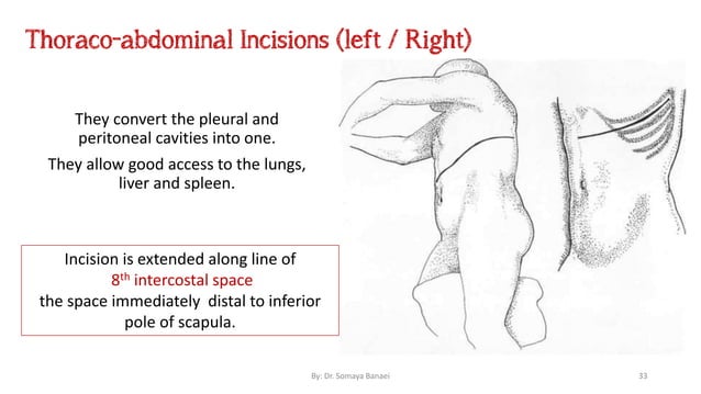 Surgical incisions | PDF