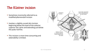 Surgical incisions | PPT