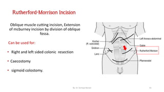 Surgical incisions | PPT
