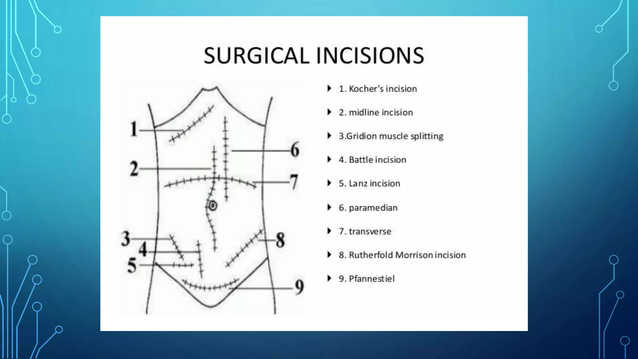 Surgical incisions | PPTX