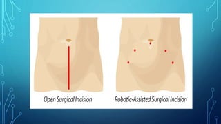 Surgical incisions | PPTX