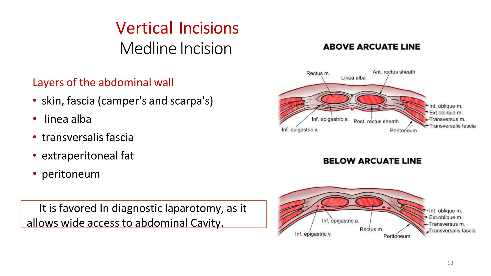 surgicalincisions.pptx