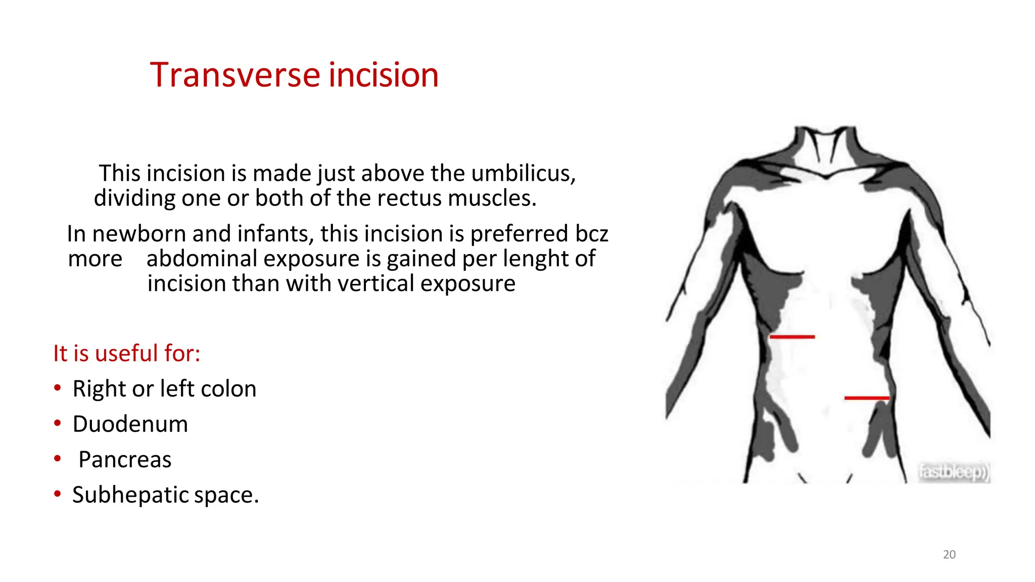 surgicalincisions.pptx