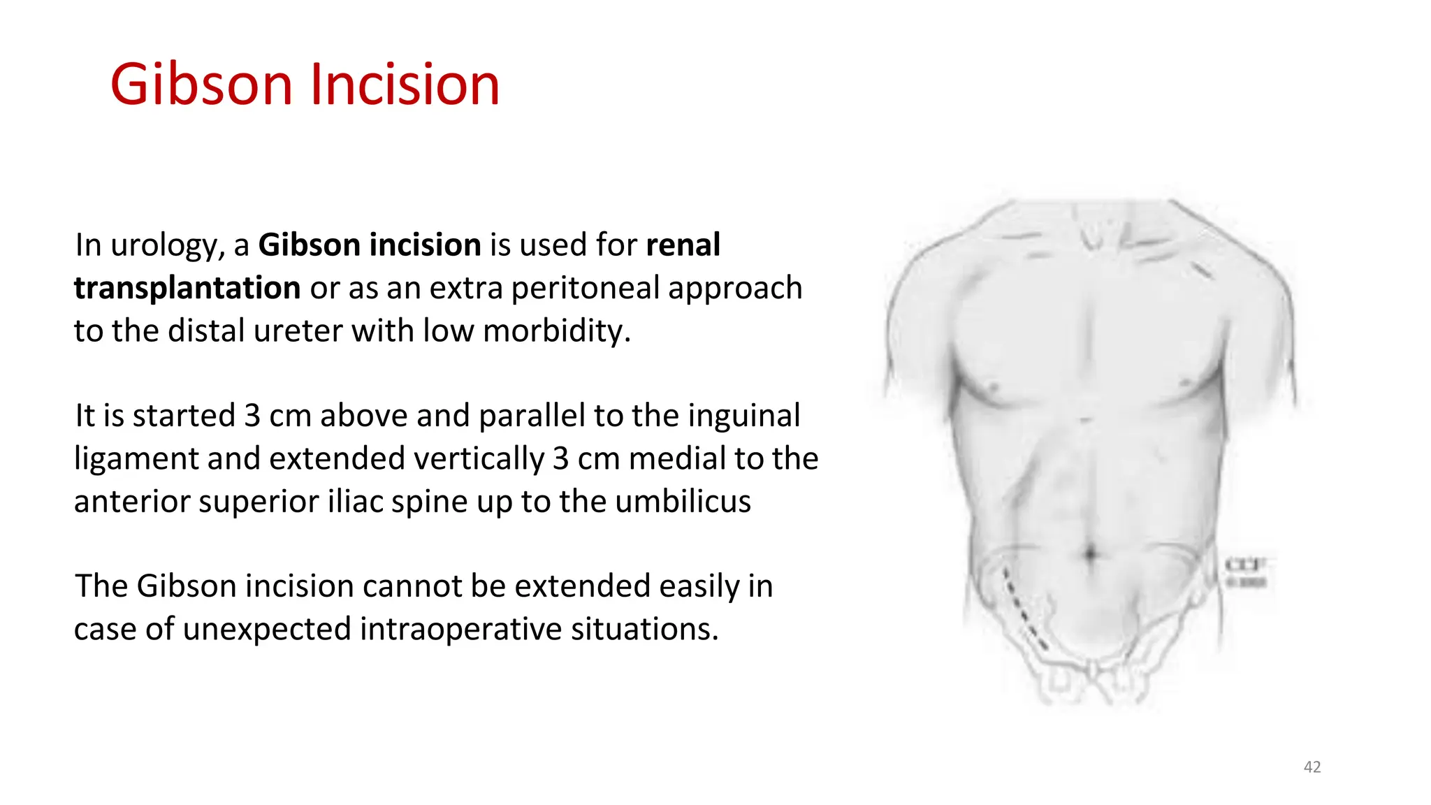 surgicalincisions.pptx