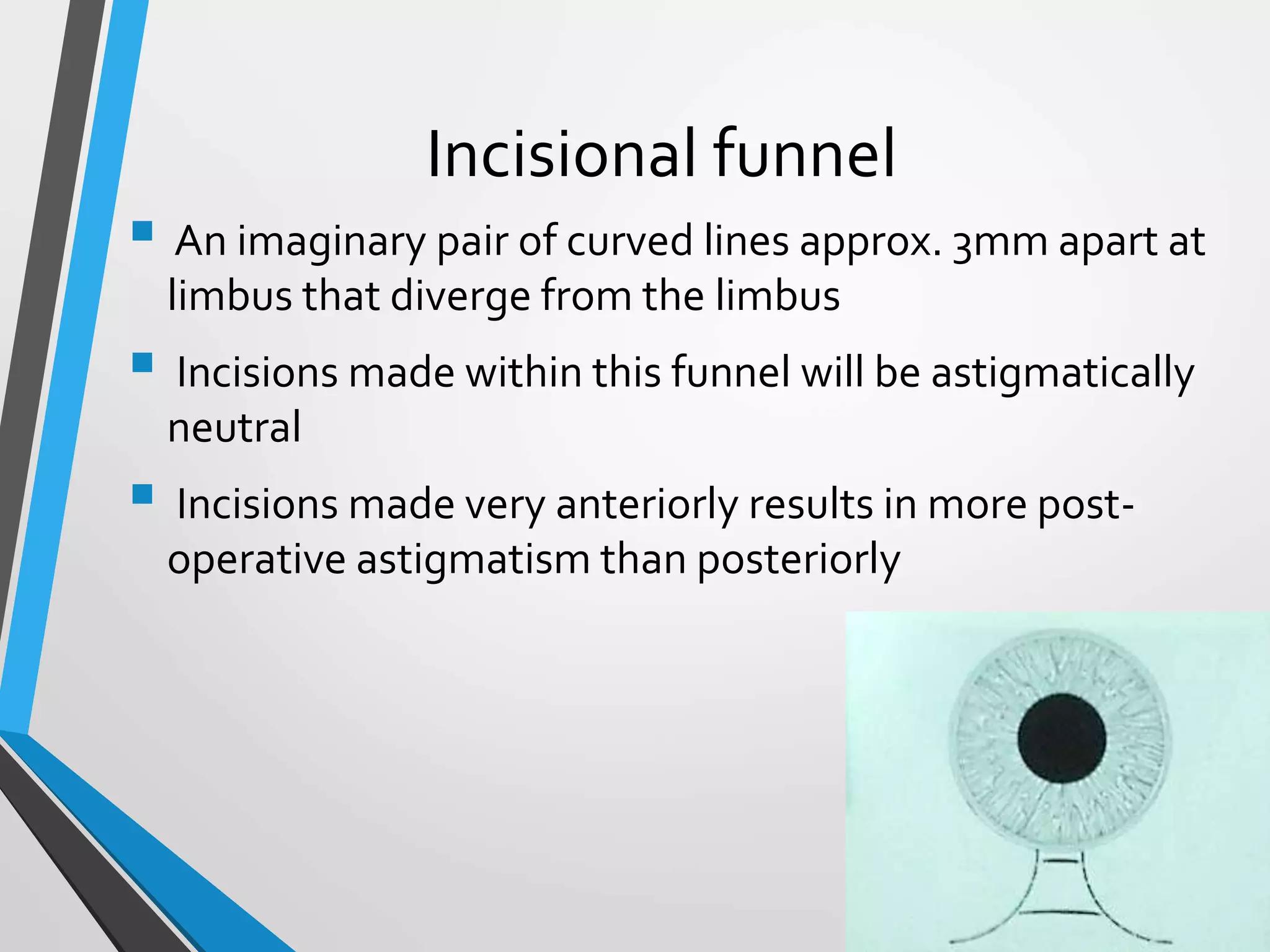 Surgical induced astigmatism | PPTX