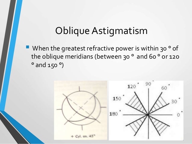 Surgical induced astigmatism