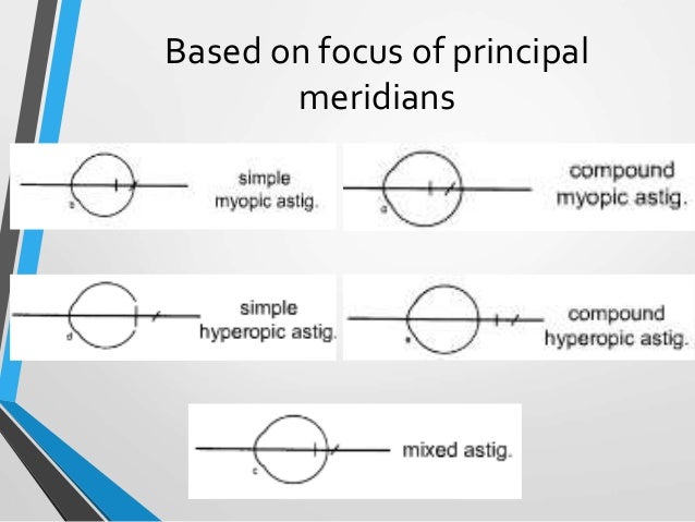 Surgical induced astigmatism