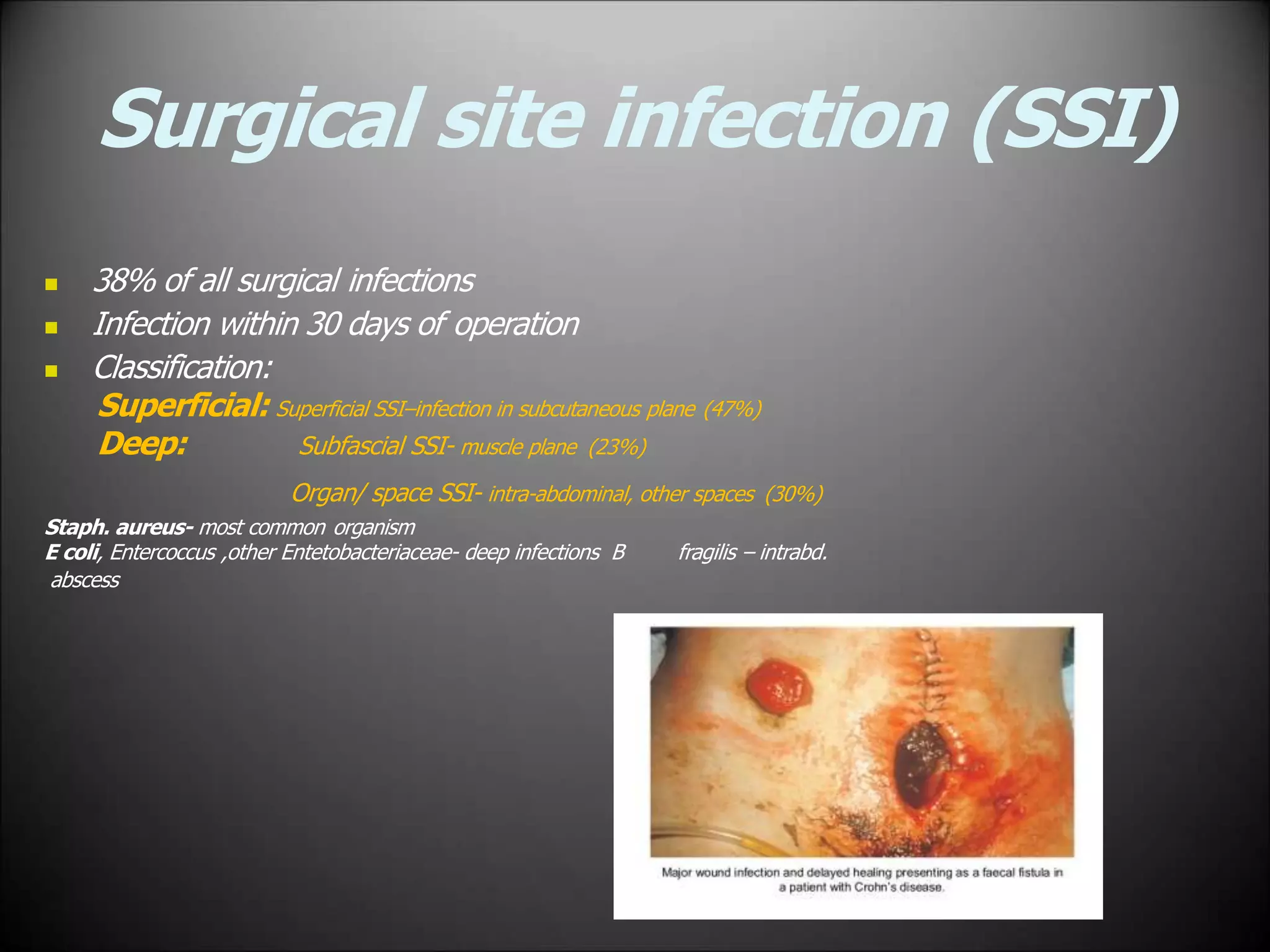 Surgical infections | PPTX
