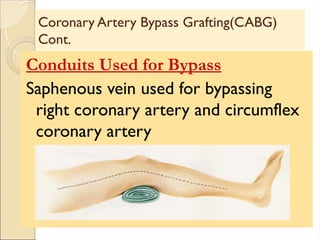 Surgical Intervention for Coronary Artery Diseases.ppt