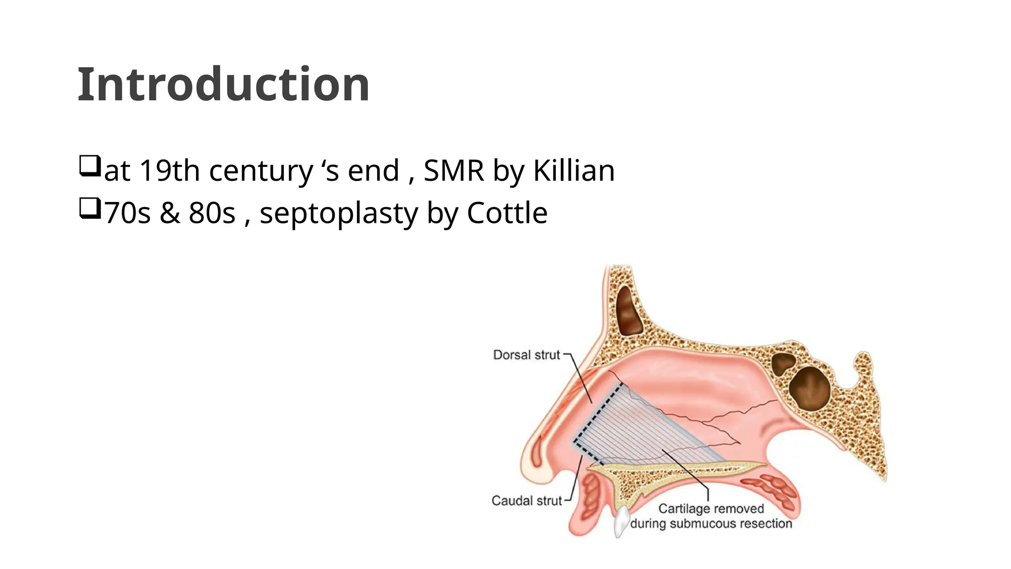 Surgical Interventions for nasal septum and turbinates abha2.pptx