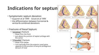Surgical Interventions for nasal septum and turbinates abha2.pptx