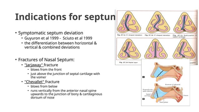 Surgical Interventions for nasal septum and turbinates abha2.pptx