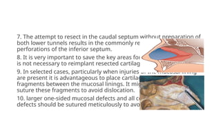 Surgical Interventions for nasal septum and turbinates abha2.pptx