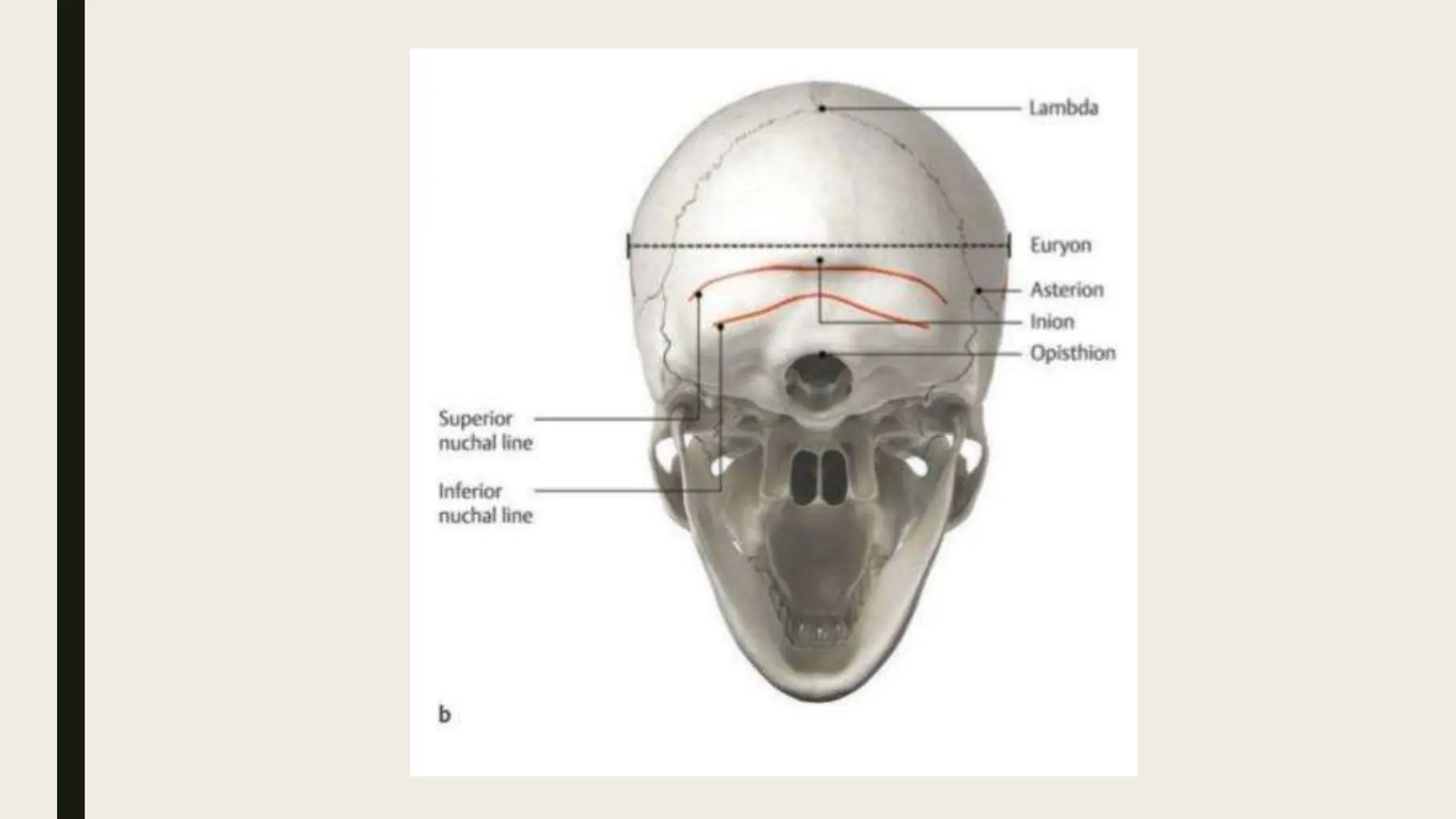 Surgical landmarks of Brain and its identification on Cranium | PPT