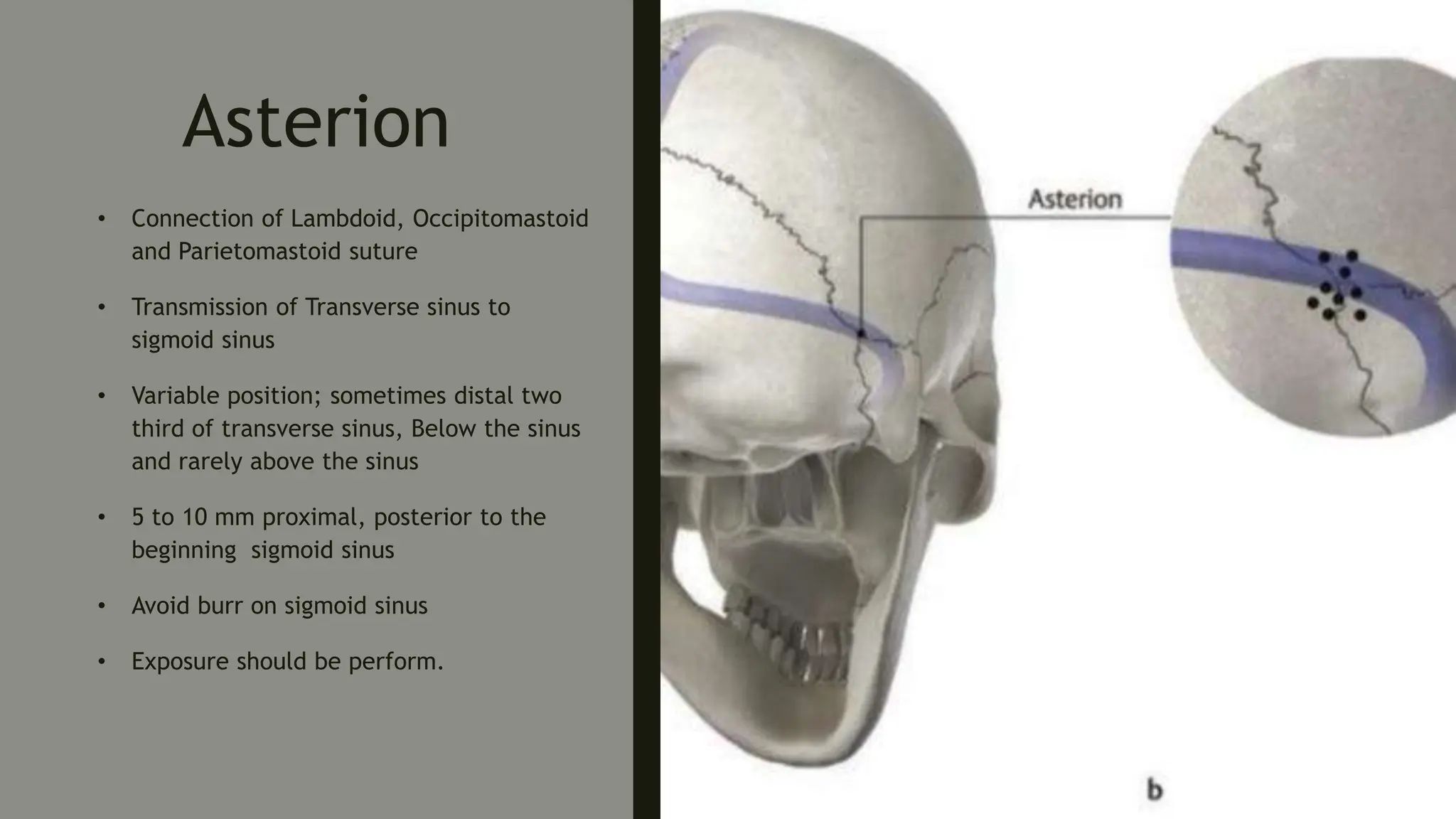 Surgical landmarks of Brain and its identification on Cranium | PPT