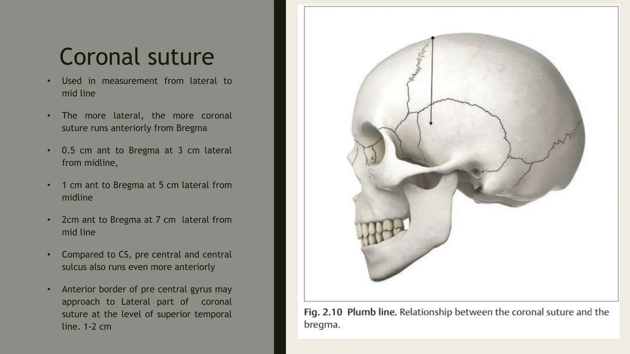 Surgical landmarks of Brain and its identification on Cranium | PPT