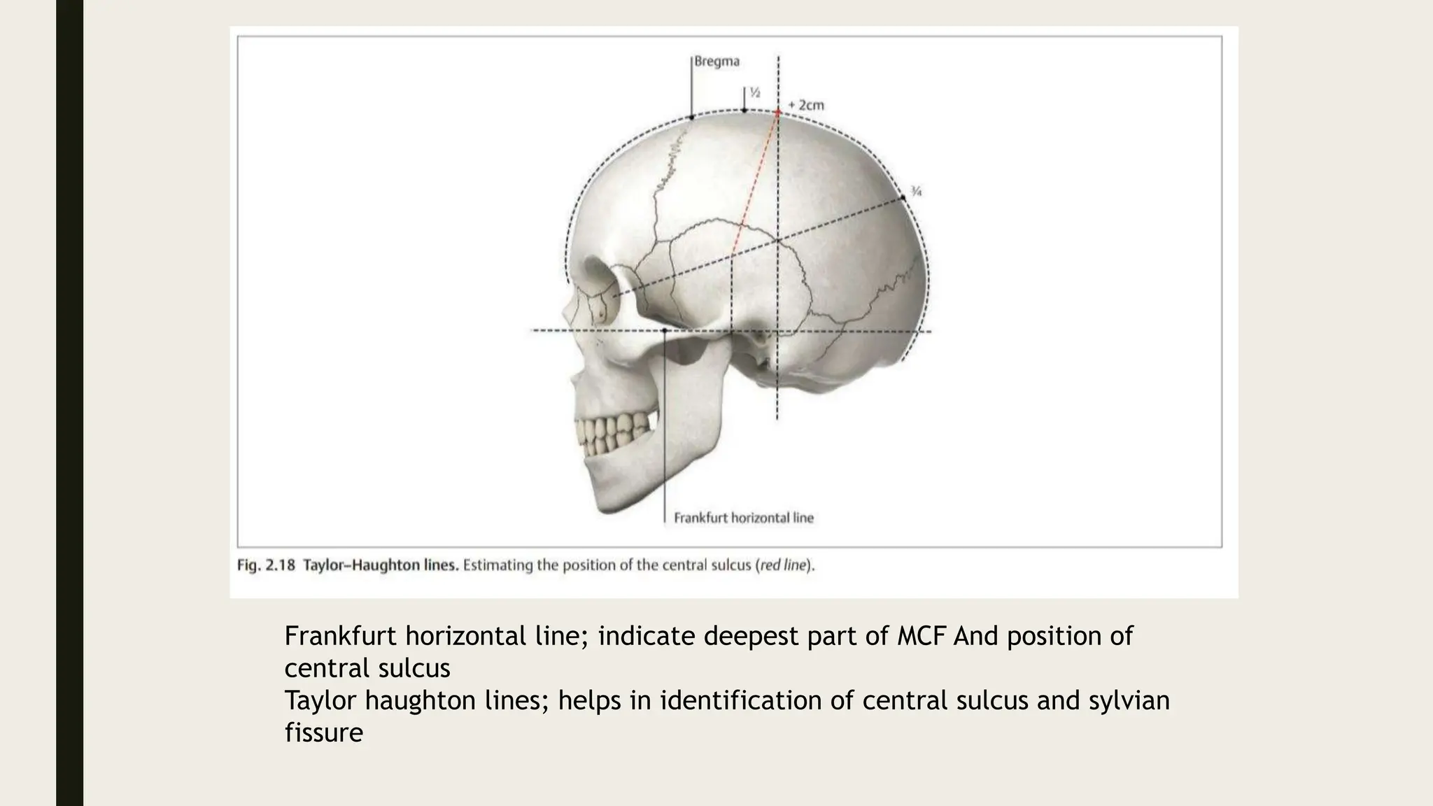 Surgical landmarks of Brain and its identification on Cranium | PPT