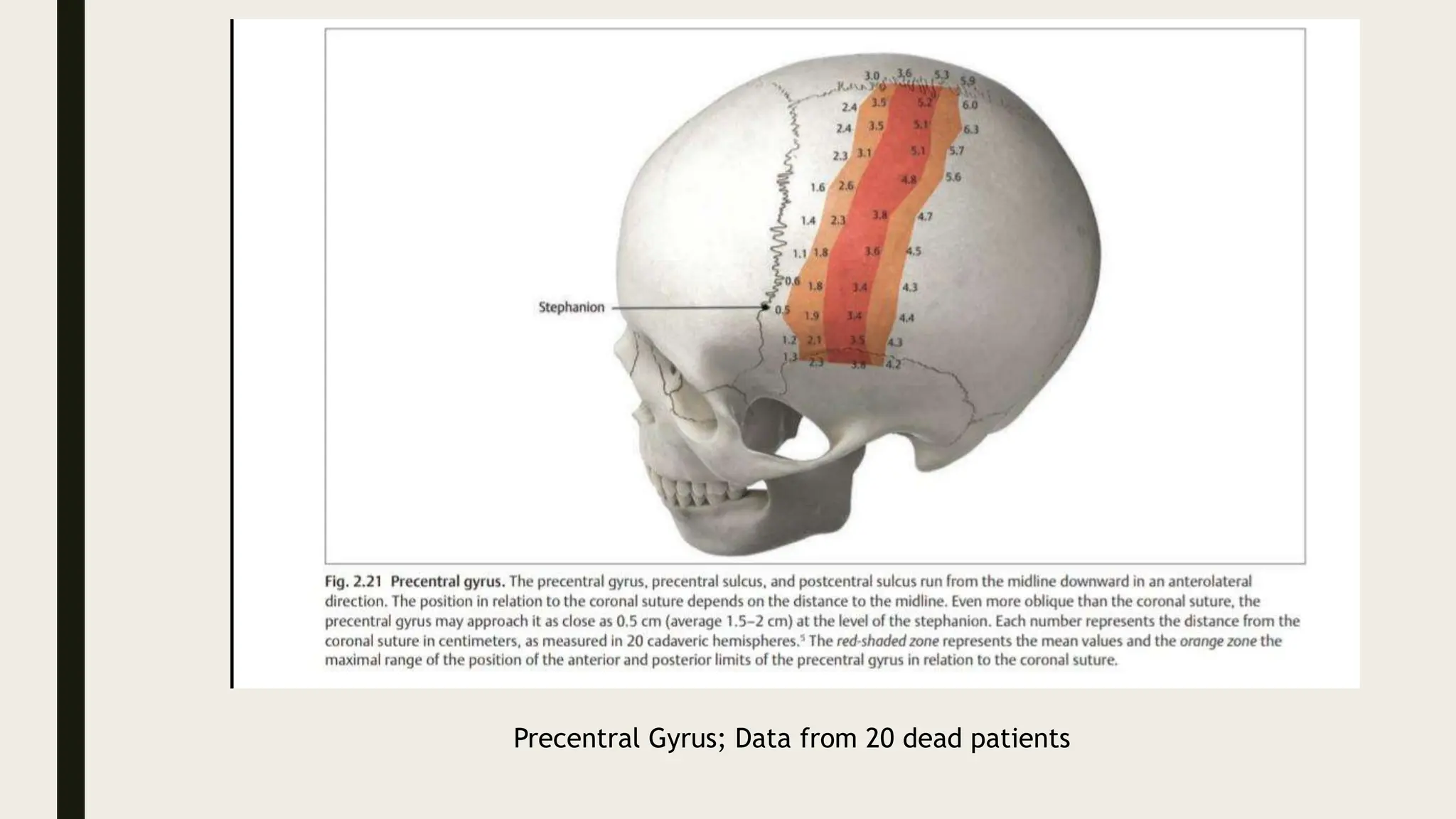 Surgical landmarks of Brain and its identification on Cranium | PPT