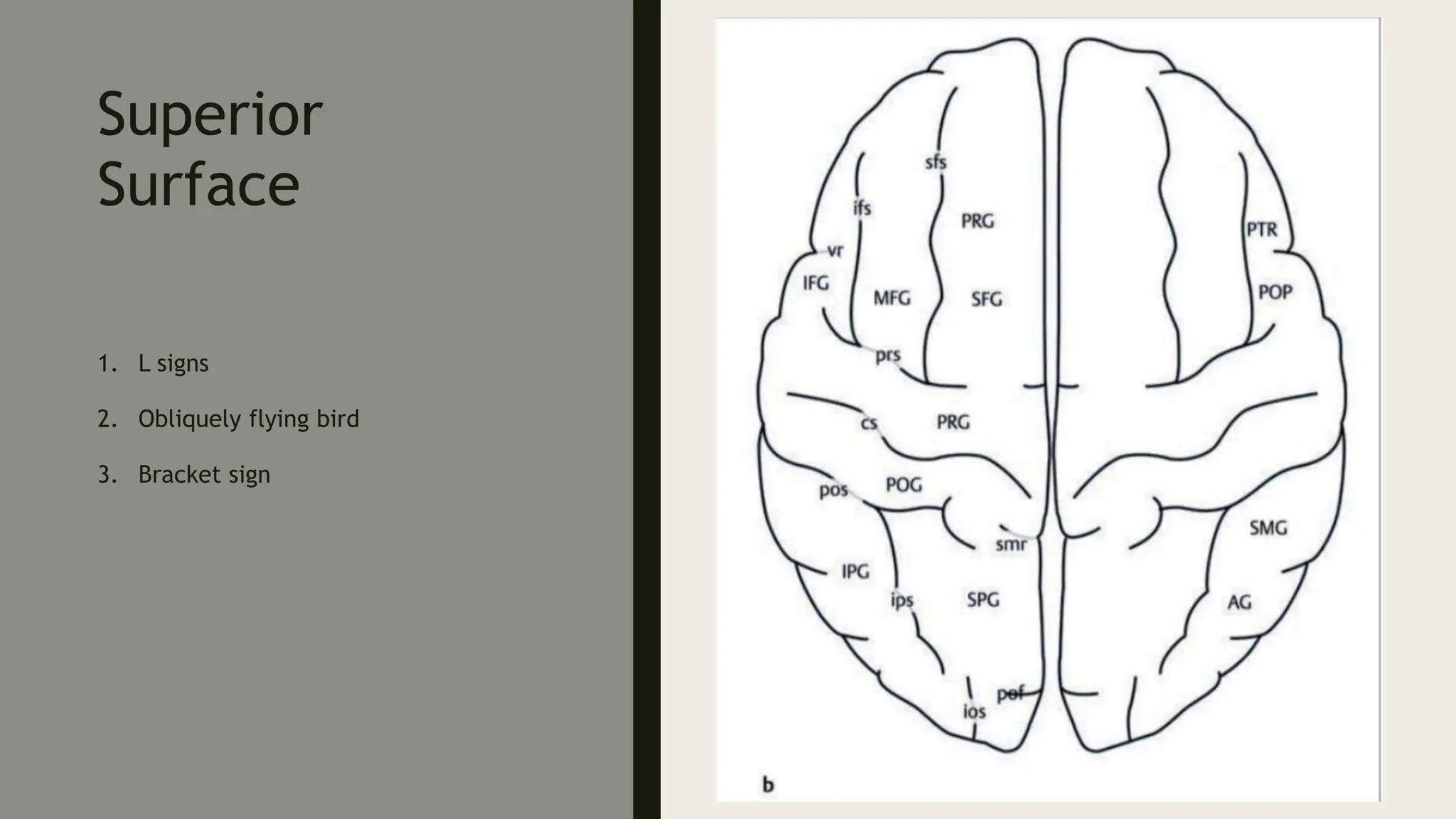 Surgical landmarks of Brain and its identification on Cranium | PPT