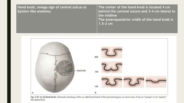 Surgical landmarks of Brain and its identification on Cranium | PPT
