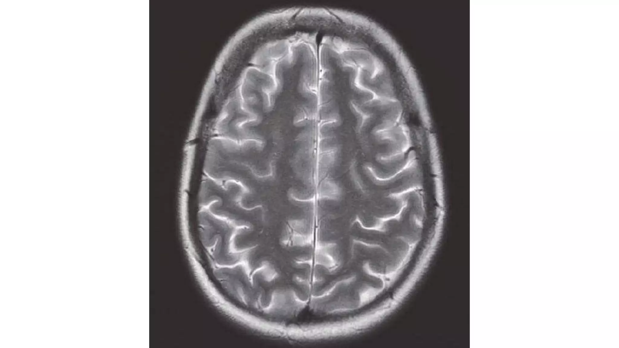 Surgical landmarks and sectional anatomy in neurosurgery | PPTX