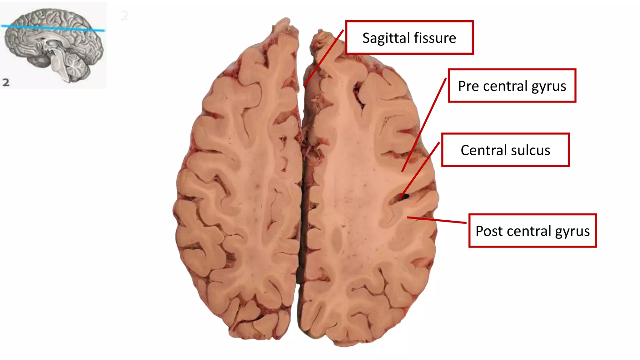 Surgical landmarks and sectional anatomy in neurosurgery | PPTX