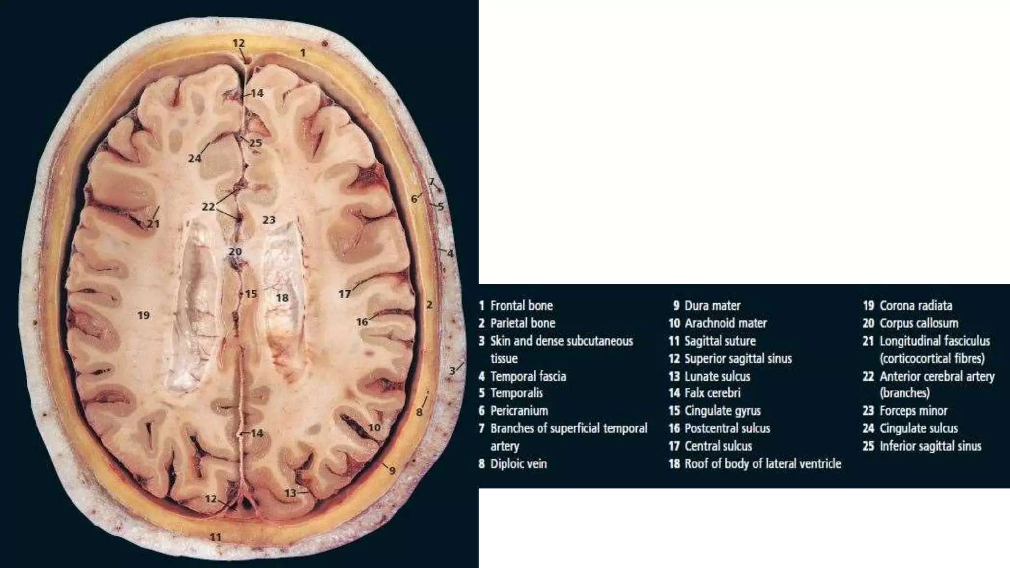 Surgical landmarks and sectional anatomy in neurosurgery | PPTX