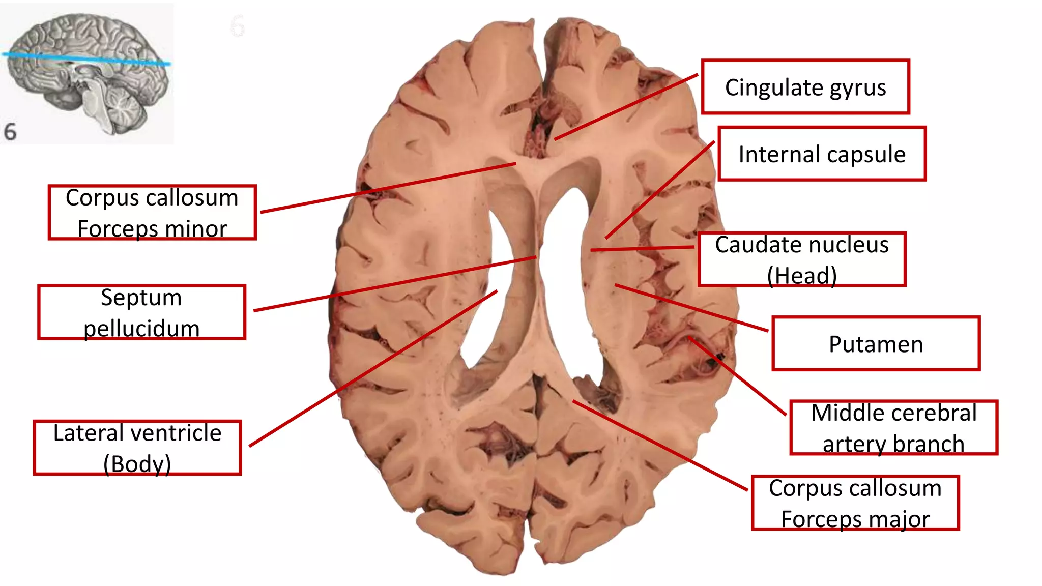 Surgical landmarks and sectional anatomy in neurosurgery | PPTX