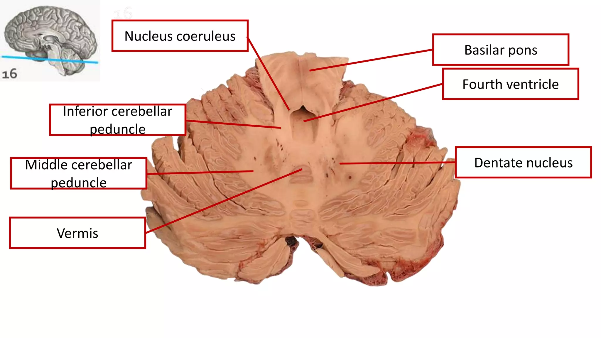 Surgical landmarks and sectional anatomy in neurosurgery | PPTX